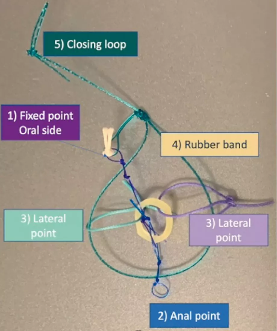 E-Video Corner – WEO’s monthly e-Video section - May | World Endoscopy ...