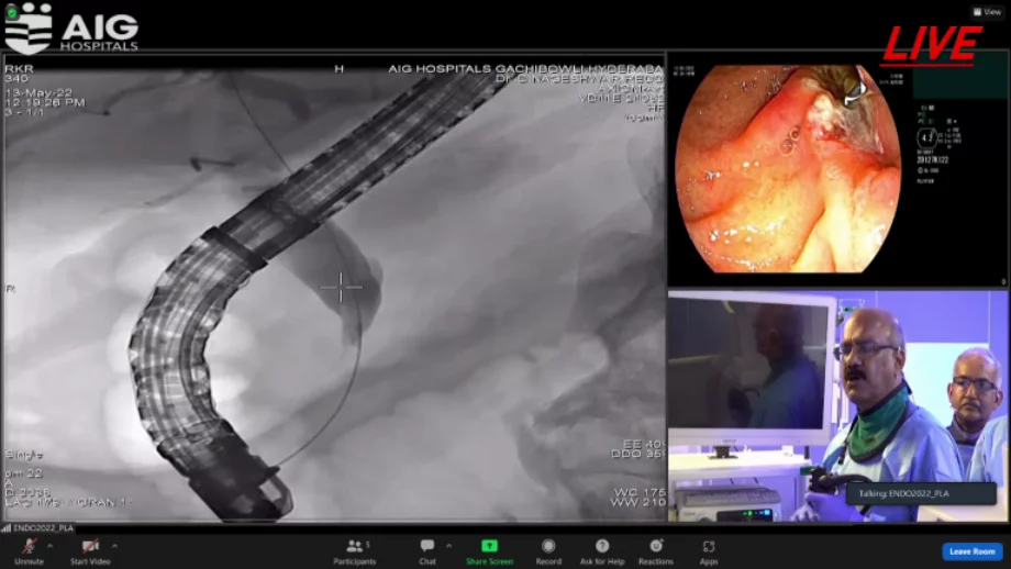 ENDO 2022 was a great success! Highlights and thanks to all who ...