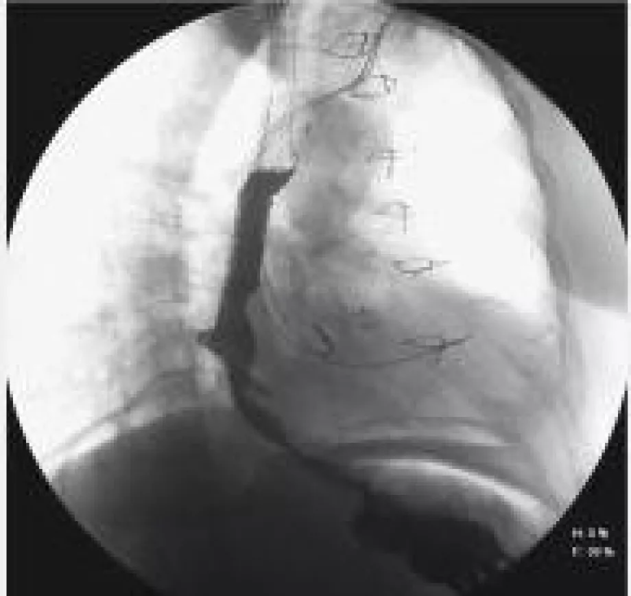 E-Video Corner – WEO’s monthly e-Video section - November | World ...