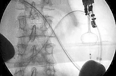 Resources | World Endoscopy Organization