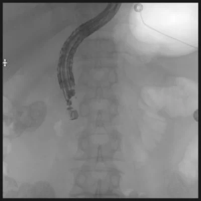 Resources | World Endoscopy Organization