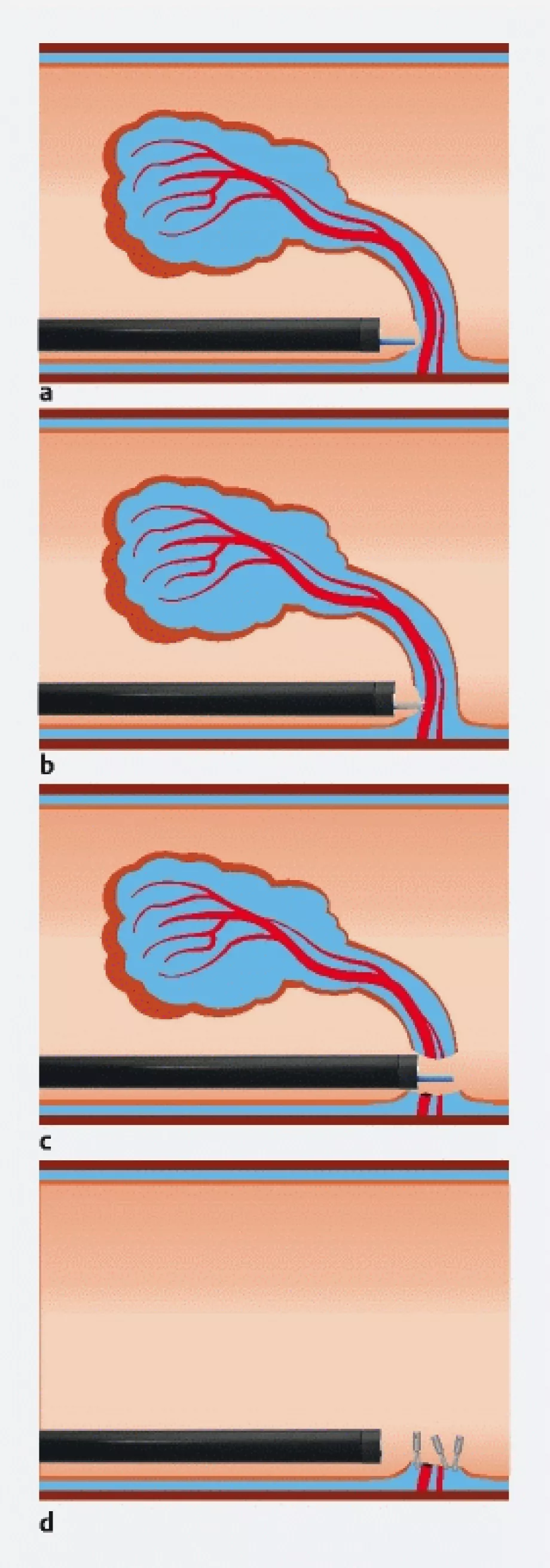E-Video Corner – WEO’s monthly e-Video section - November | World ...